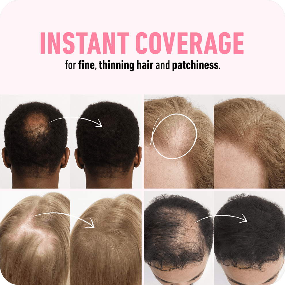 Hair Thickening Fibers – Instant Volume & Natural Coverage | Boldify ...
