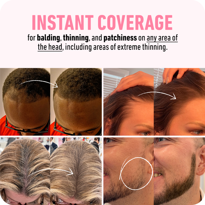 Open media 4 in modal